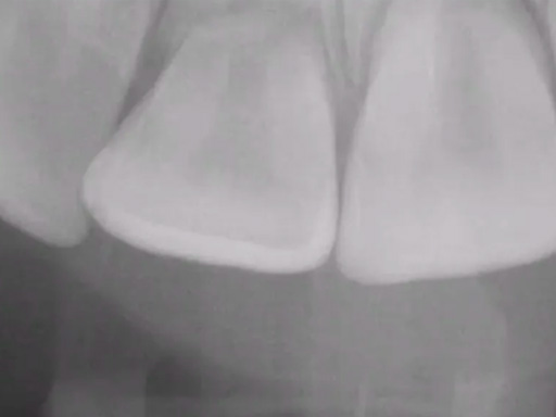 A Tale of Resilience: Restoring a Smile Against All Odds - Seasons of ...