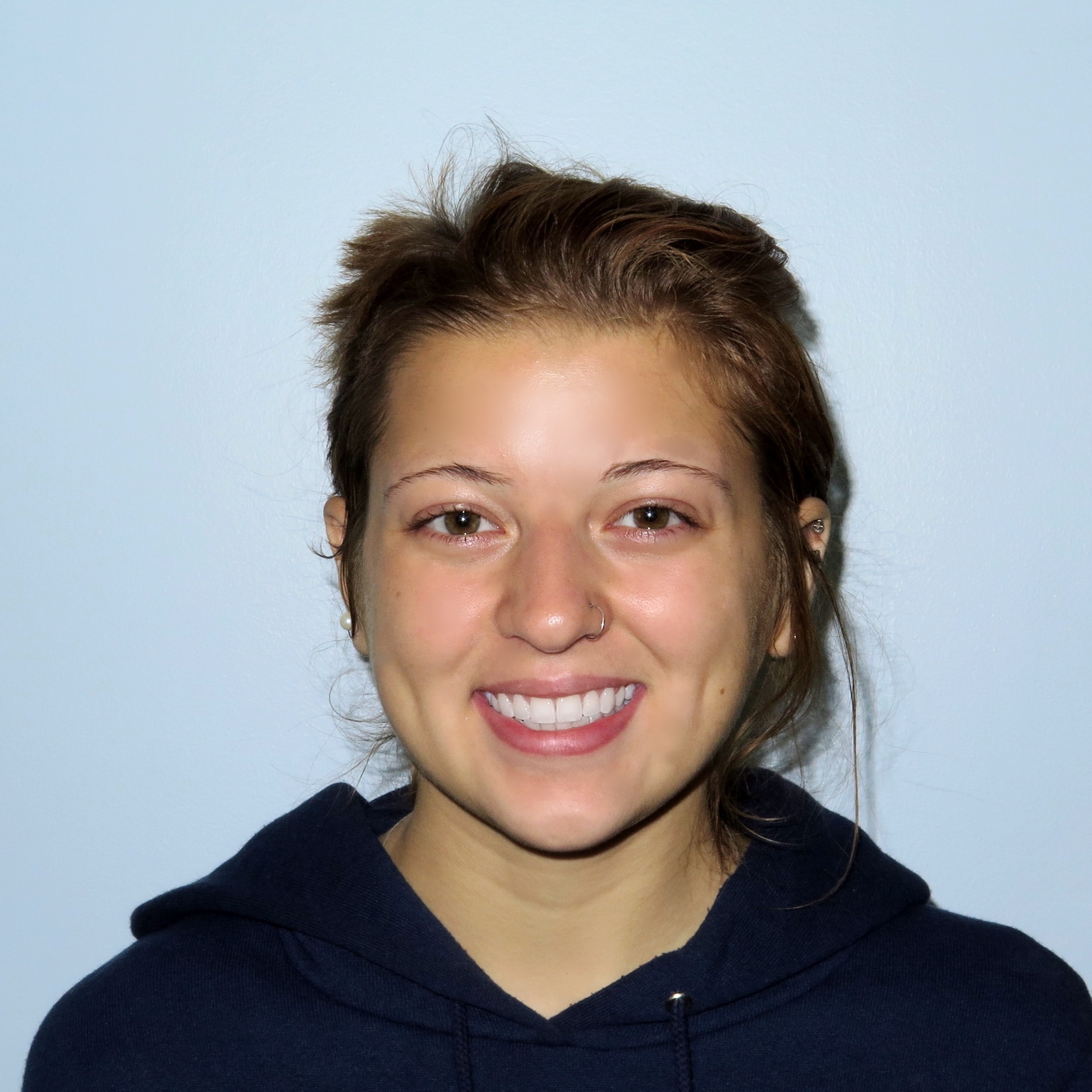 Raccoons, rabies and a follow up dental visit with Rachel Borch ...